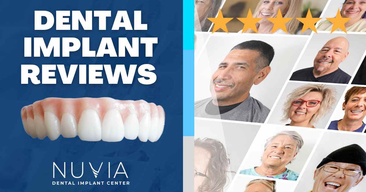 Nuvia Dental Implant Center Reviews